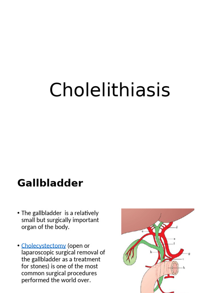 cholelithiasis | PDF | Gallbladder | Bile