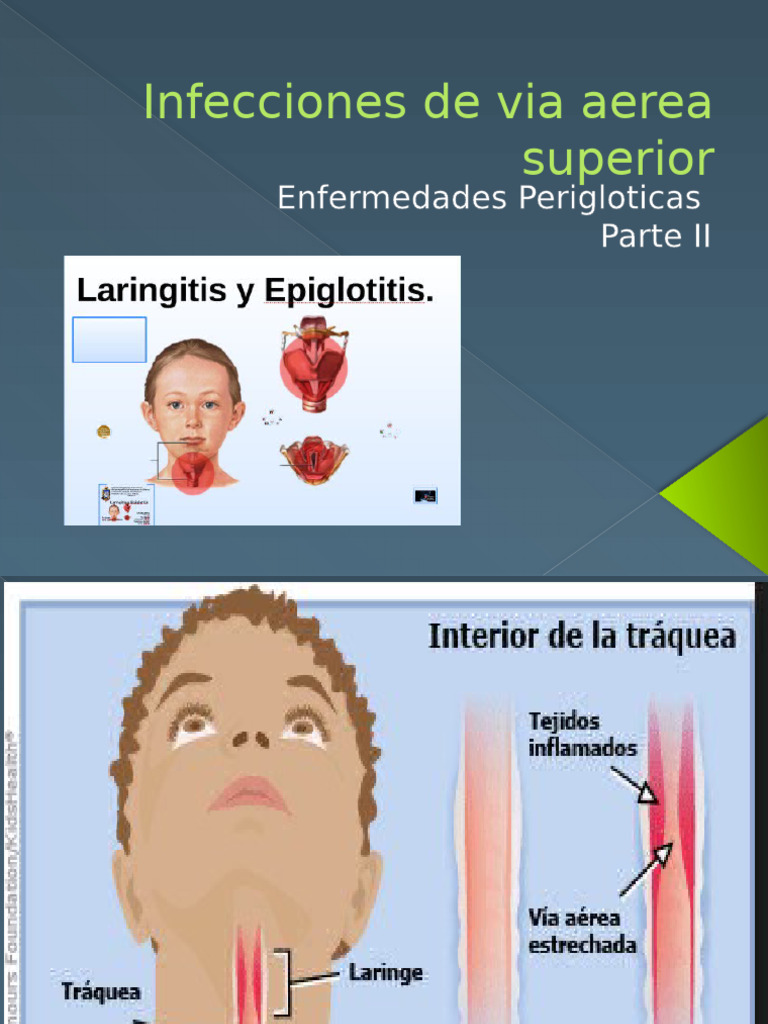 IVAS II | PDF | Inmunología | Enfermedades respiratorias