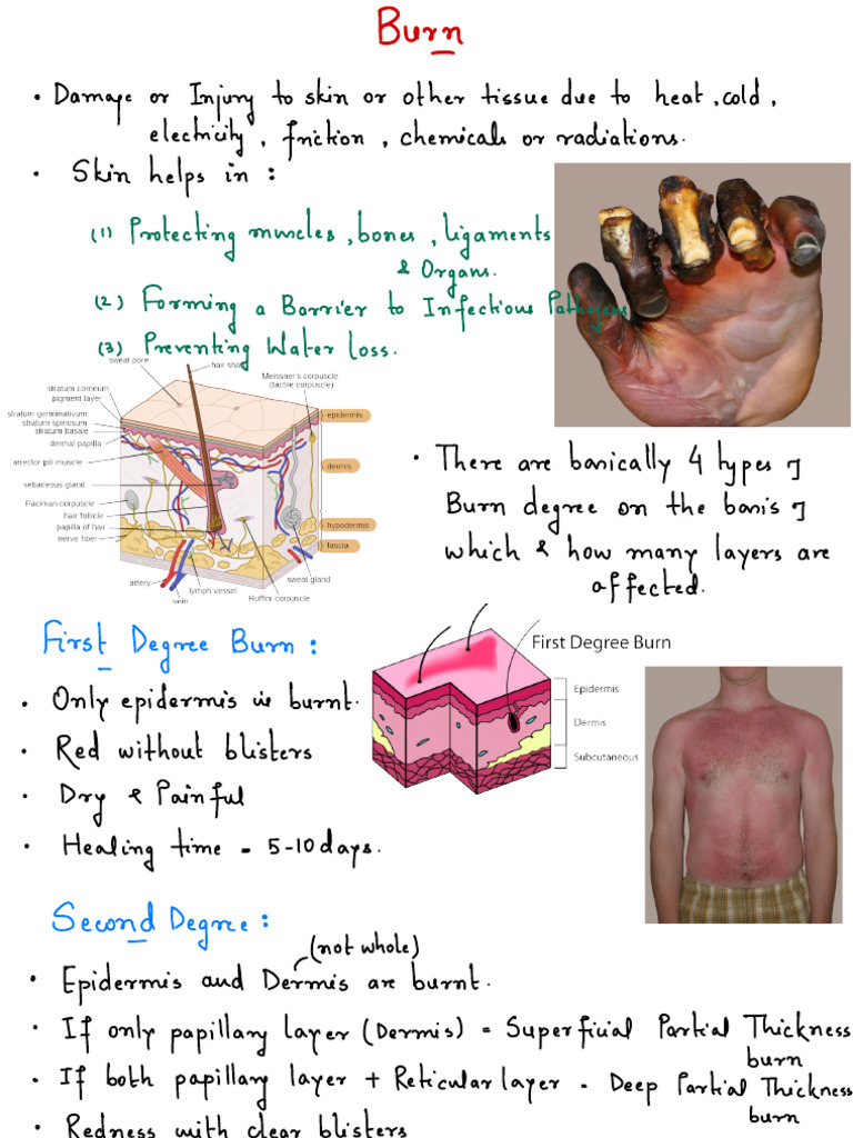 Burn | PDF | Burn | Skin