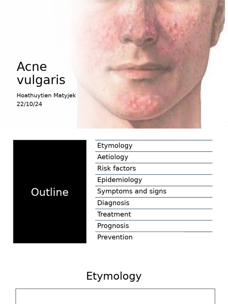 Acne | PDF