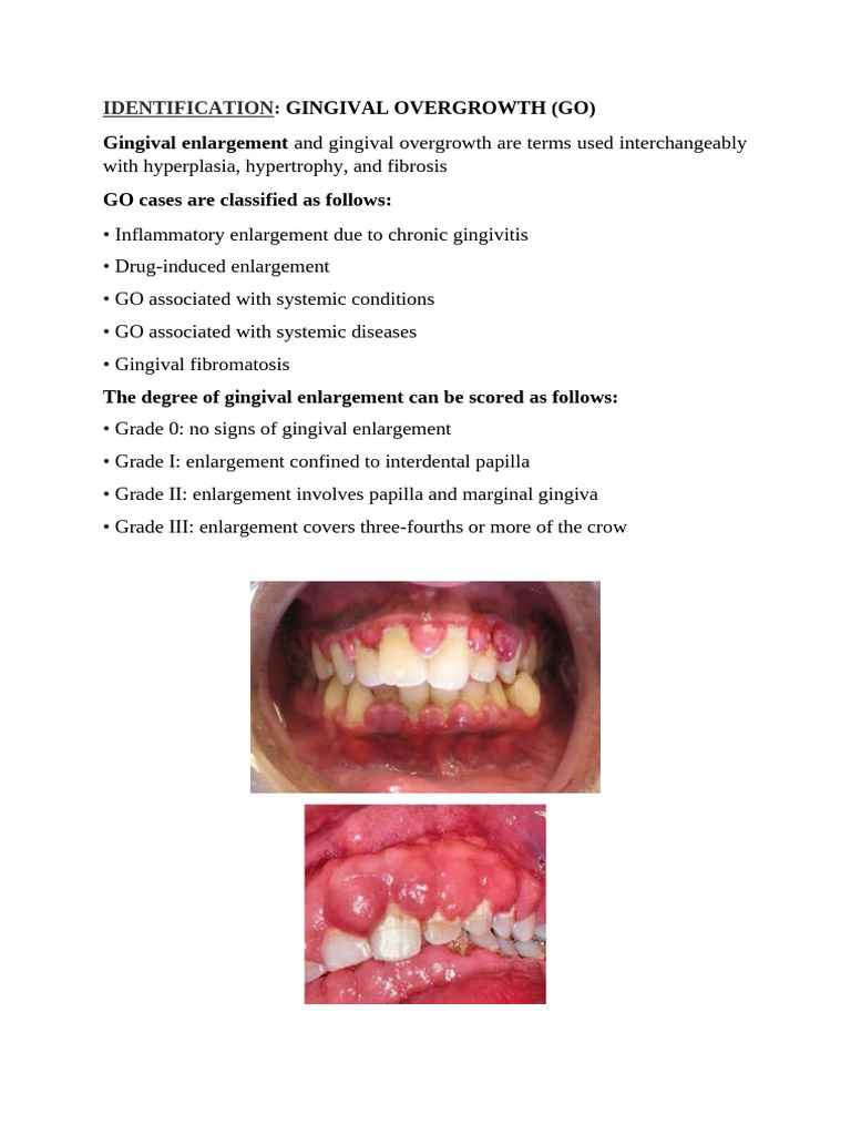 Gingival Overgrowth Guide | PDF