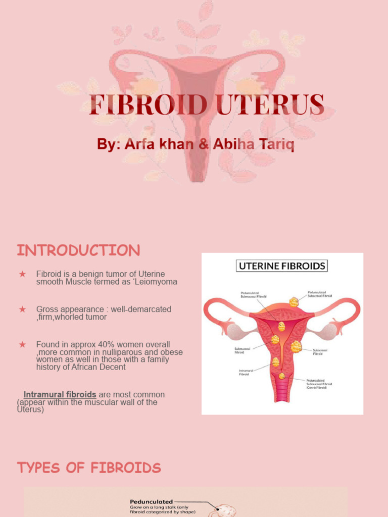 Fibroid Uterus | PDF | Medical Specialties | Gynaecology