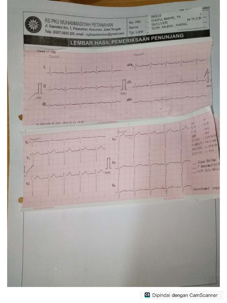 Ekg TN Syaiful Bakhri | PDF