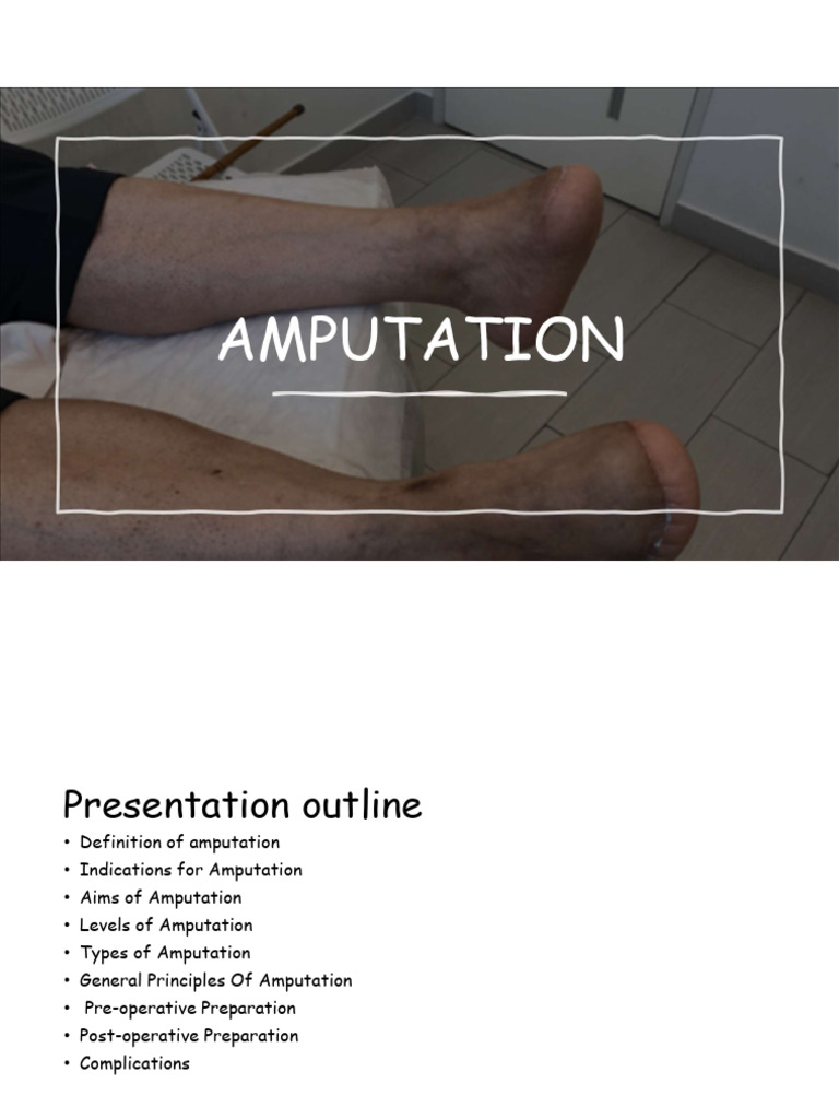 PDF - Lect - NSG 405 - Amputation | PDF | Amputation | Prosthesis