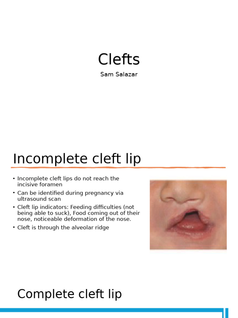 Clefts | PDF | Human Head And Neck | Diseases And Disorders
