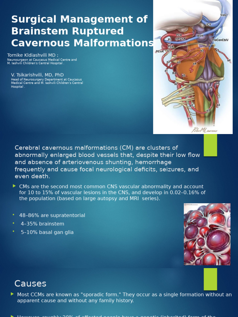 Surgical Management of Brainstem Ruptured Cavernomas | PDF | Magnetic ...