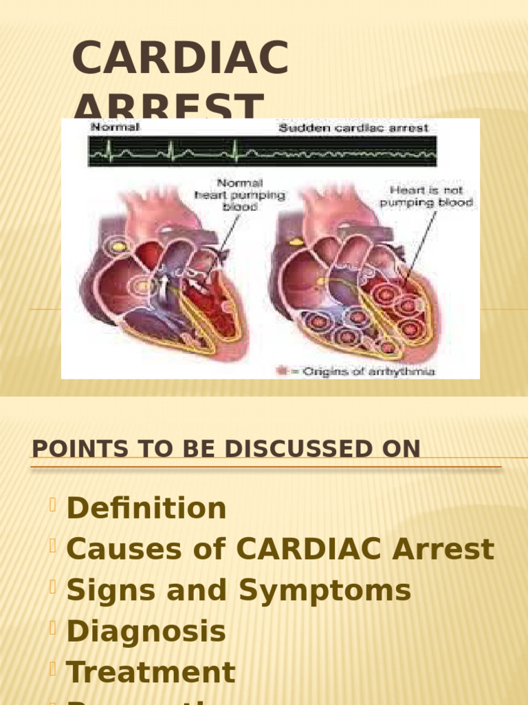 CARDIAC Arrest | PDF