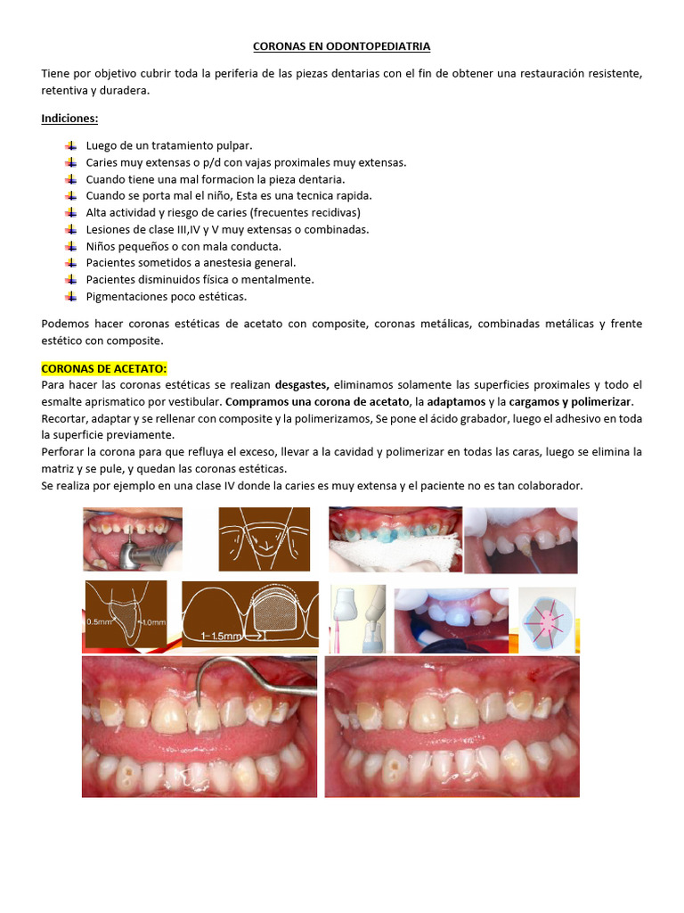 Coronas en Odontopediatria | PDF | Compuesto Dental | Ramas de Odontología