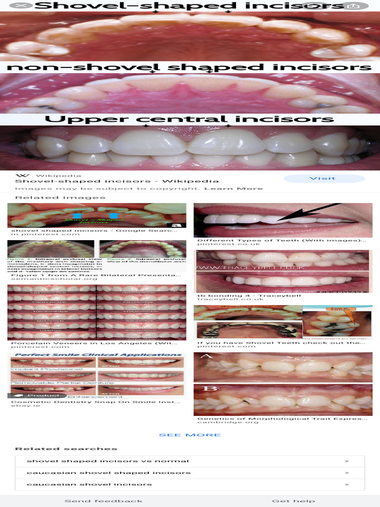Upper Teeth - Google Search | PDF