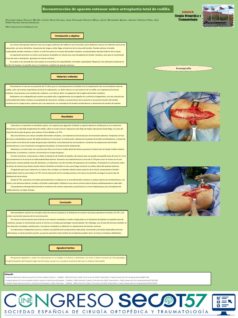 Reconstrucción de Aparato Extensor Sobre Artroplastia Total de Rodilla ...