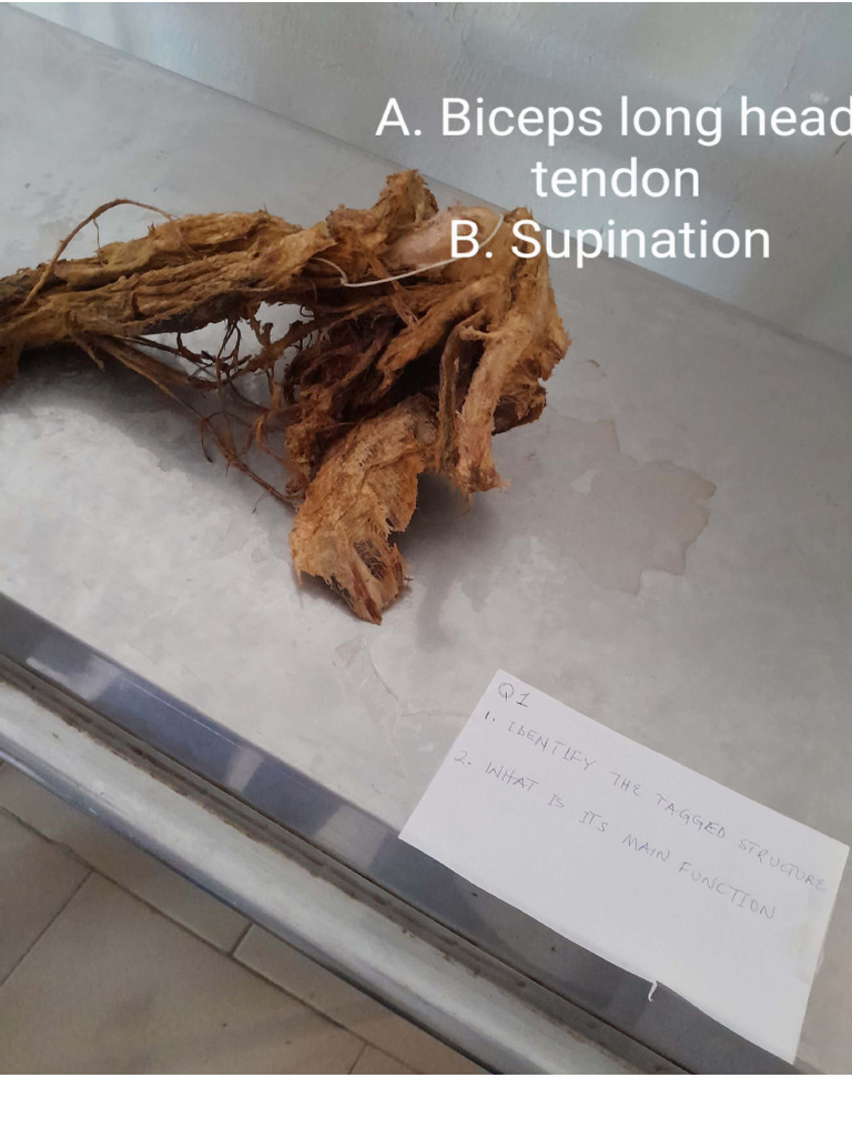 Upper Limb Spotting Test MB2 2023 | PDF