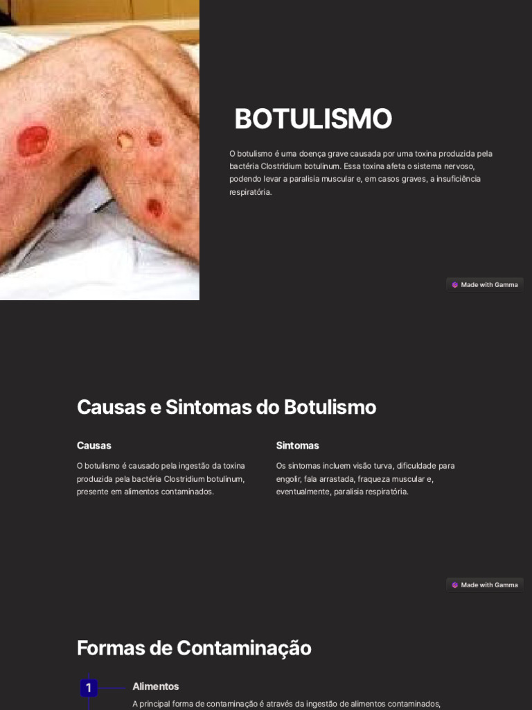 BOTULISMO | PDF | Doenças e distúrbios humanos | Remédio