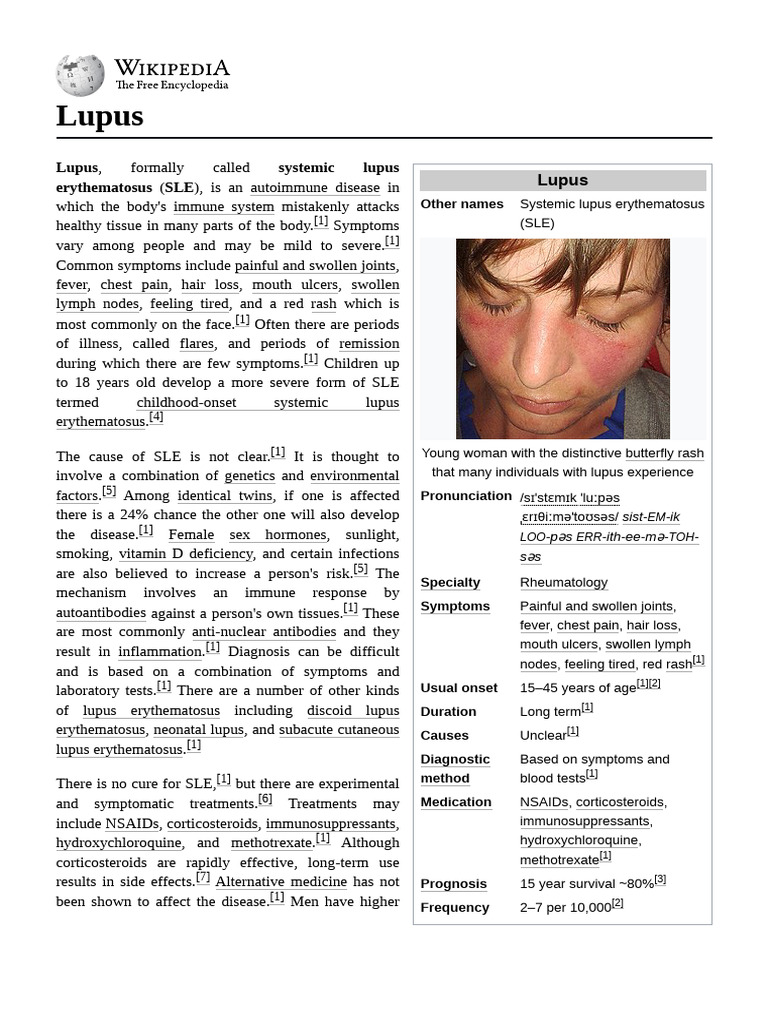 Lupus | PDF | Apoptosis | B Cell