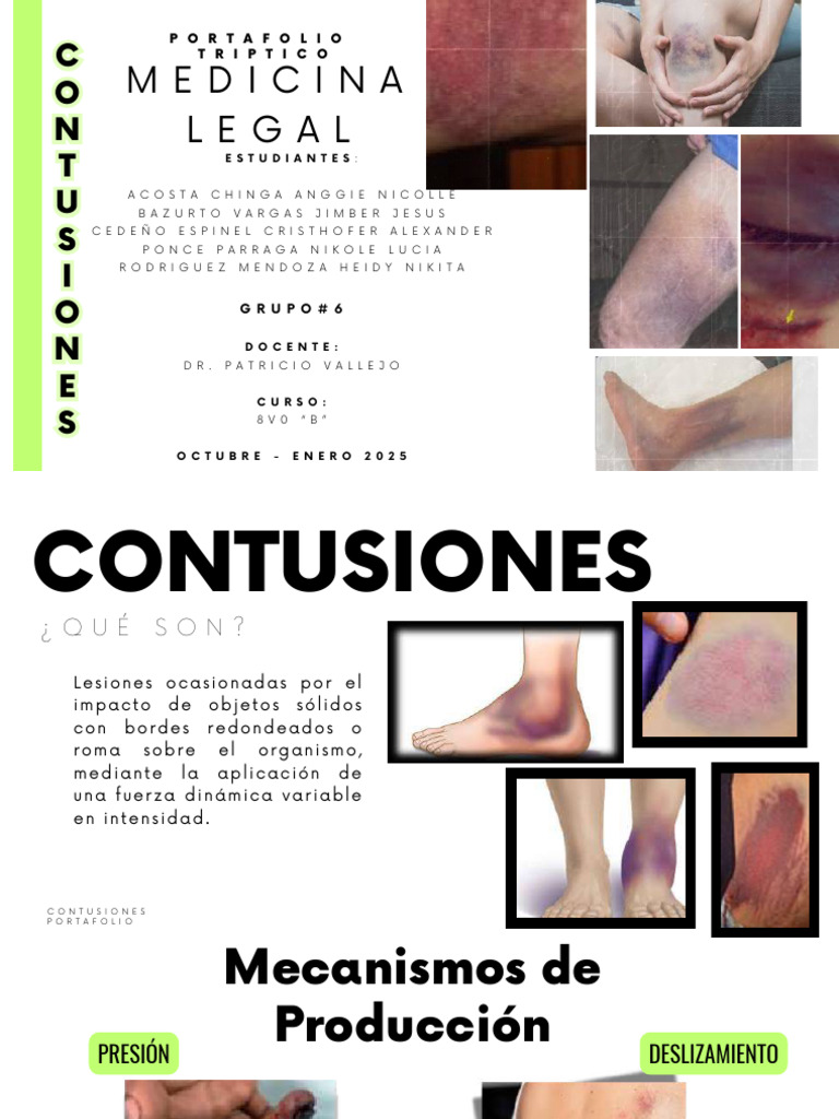 Portafolio-Triptico CONTUSIONES G6 | PDF | Biomecánica | Dermatología
