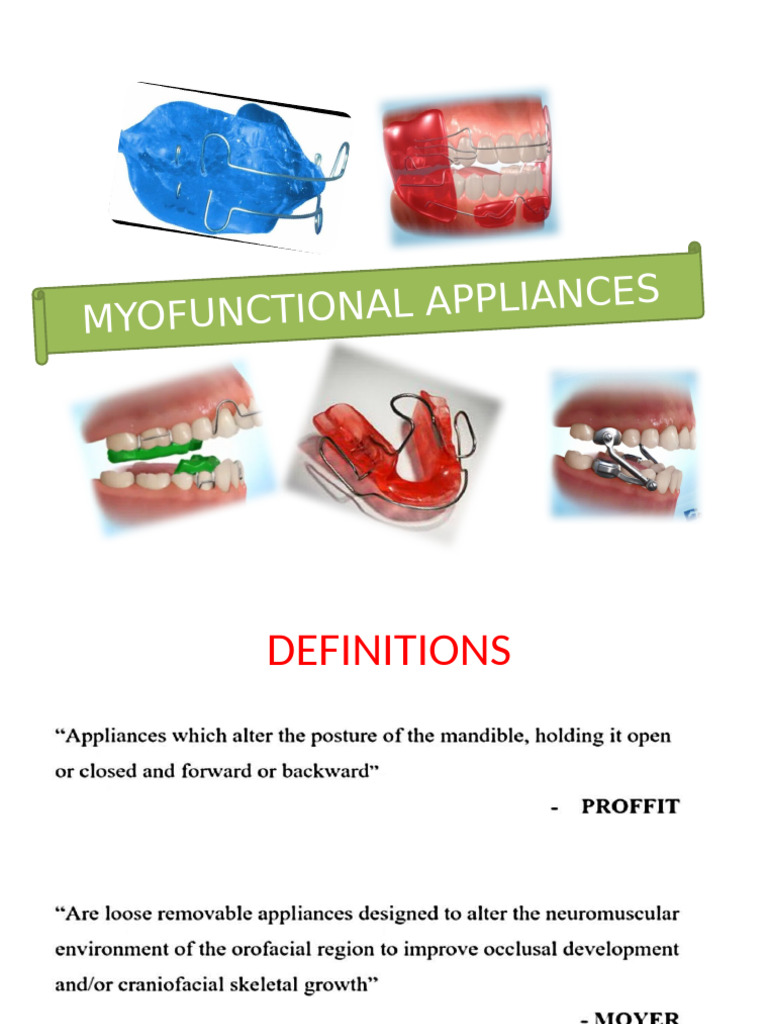 Mfa | PDF | Orthodontics | Mouth