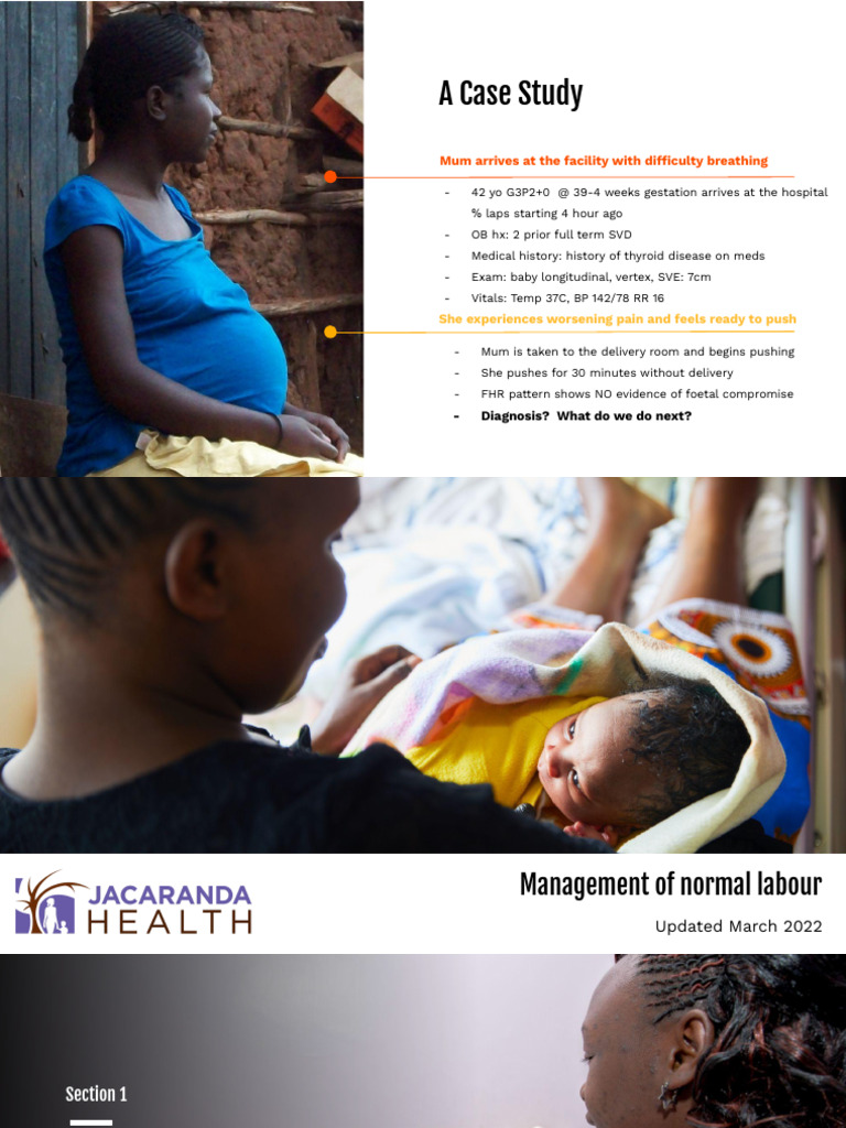 Management+of+Normal+Labour | PDF | Childbirth | Pregnancy