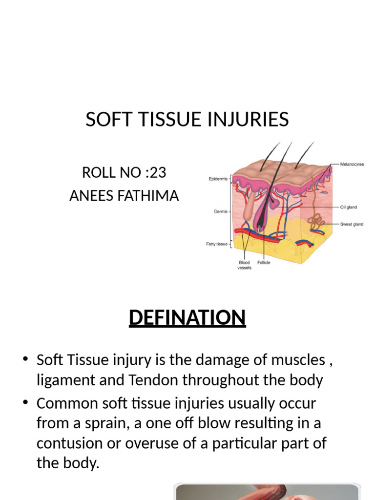Understanding Soft Tissue Injuries | PDF | Elbow | Musculoskeletal System