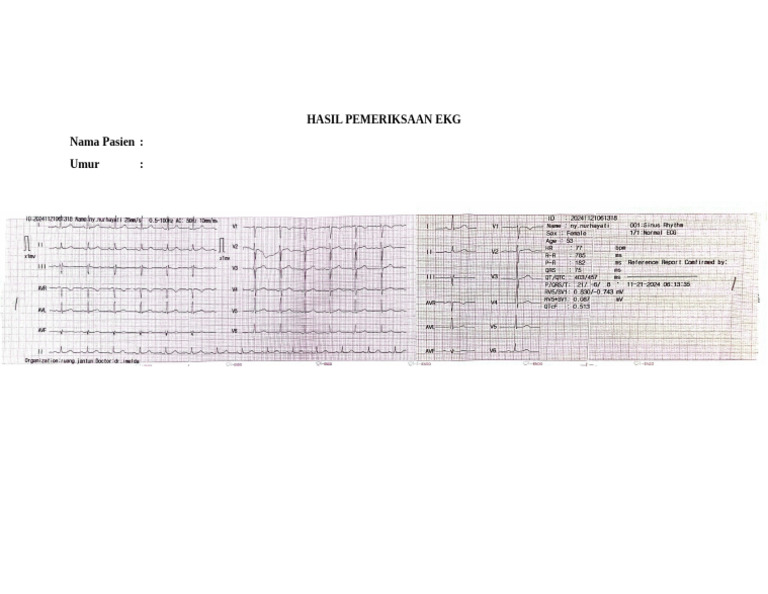 HASIL PEMERIKSAAN EKG | PDF