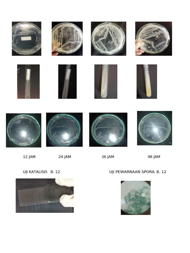 Foto Mikro Penanam Biakan | PDF