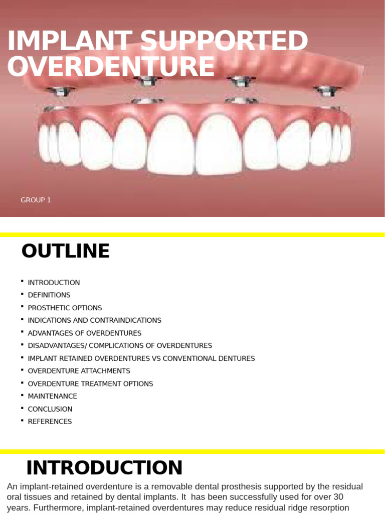 Implant-Supported Overdenture Guide | PDF | Dental Implant | Dentures