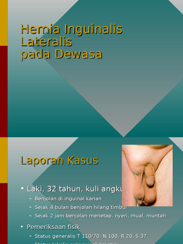 Reno - Hernia Inguinalis | PDF