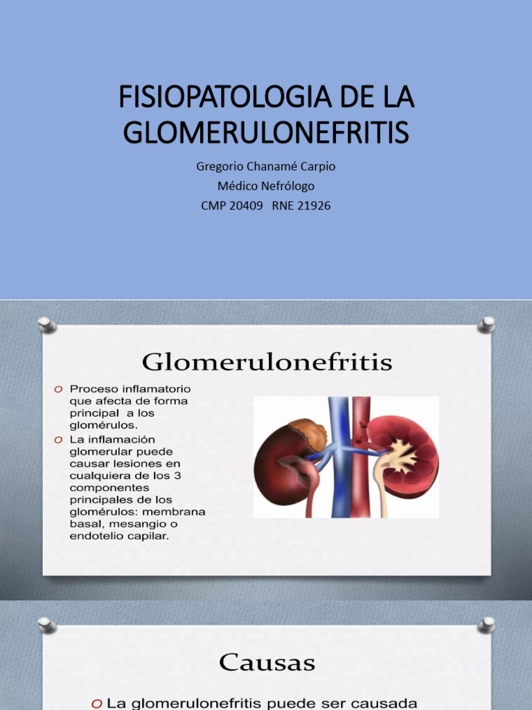 Fisiopatologia de La Glomerulonefritis | PDF