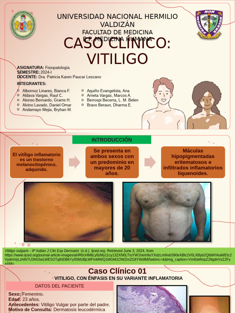 Caso Clínico 1 - Vitiligo | PDF | Especialidades Medicas | Medicina CLINICA