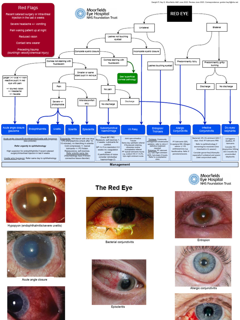 Red Eye Diagnosis and Management Guide | PDF | Cornea | Contact Lens