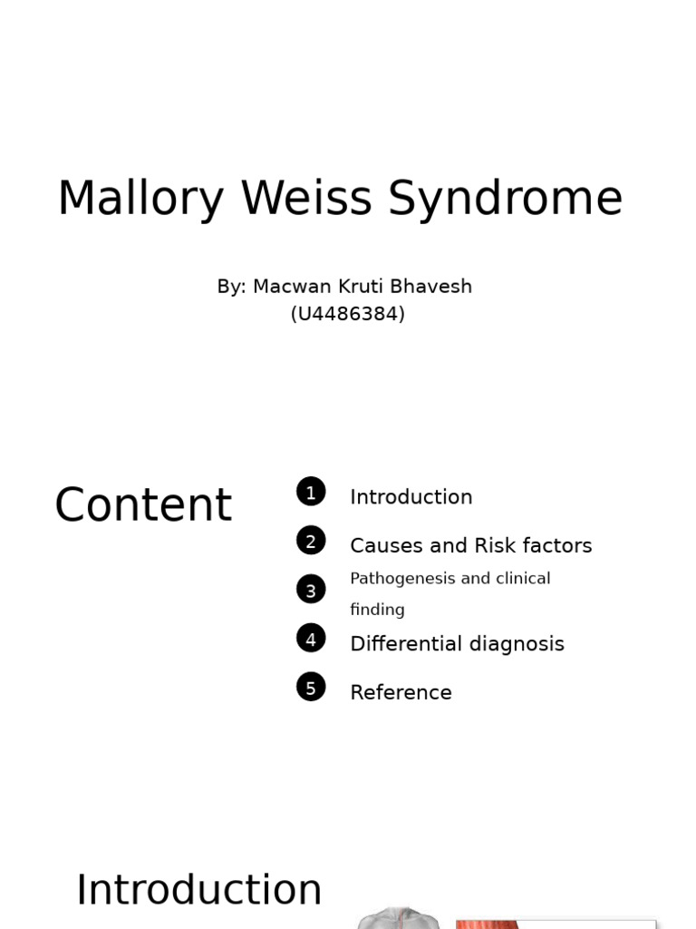 Mallory Weiss Syndrome Overview | PDF
