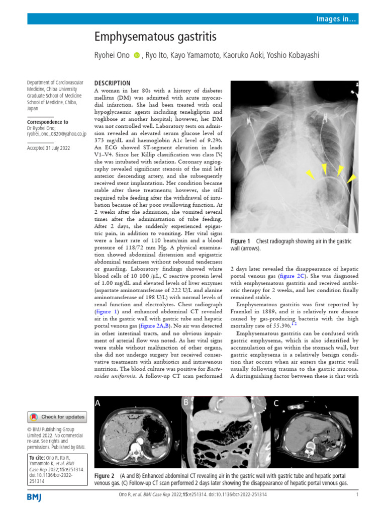 Emphysematous Gastritis | PDF | Stomach | Liver