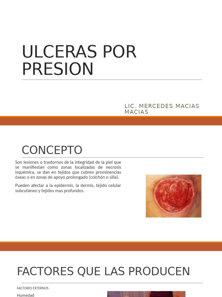 Ulceras Por Presion | PDF