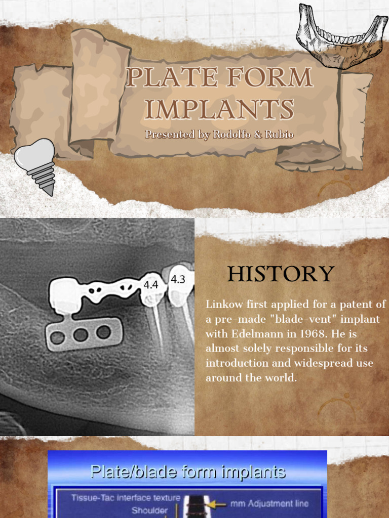 Group 12 Plate Form Implant - Rodolfo & Rubio | PDF | Dental Implant ...