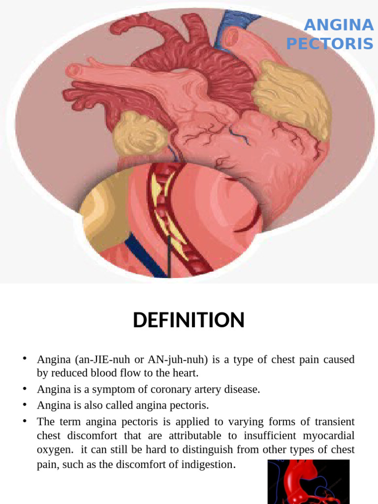 Angina Pectoris | PDF | Heart | Angiography
