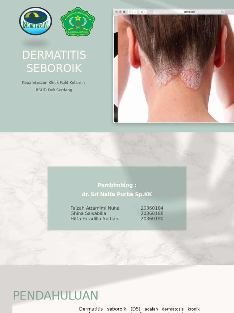 Refarat Dermatitis Seboroik | PDF