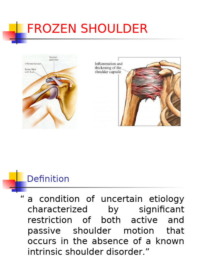 Frozen Shoulder | PDF | Anatomical Terms Of Motion | Medicine