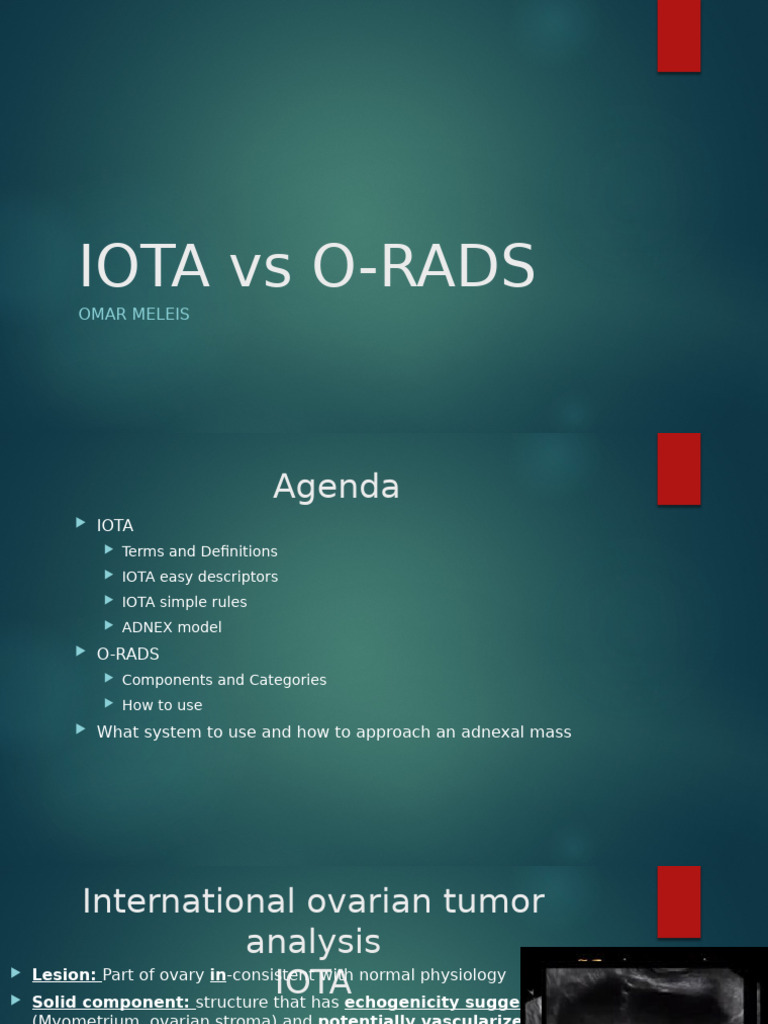 IOTA vs O-RADS: Ovarian Tumor Guidelines | PDF | Ovarian Cancer | Neoplasms