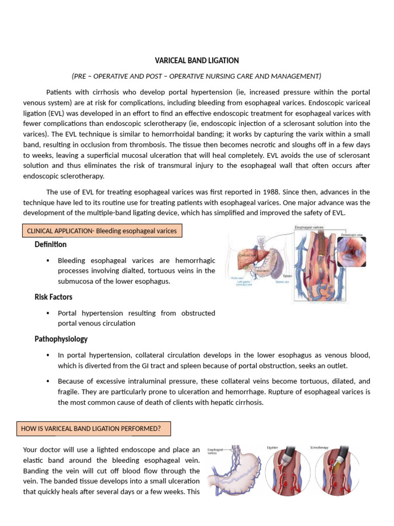 variceal band ligation | PDF | Esophagus | Medicine