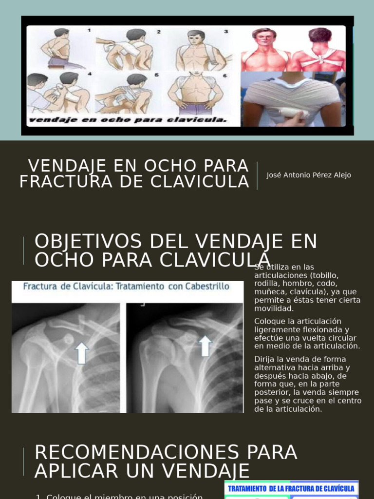Vendaje en Ocho Para Fractura de Clavicula | PDF