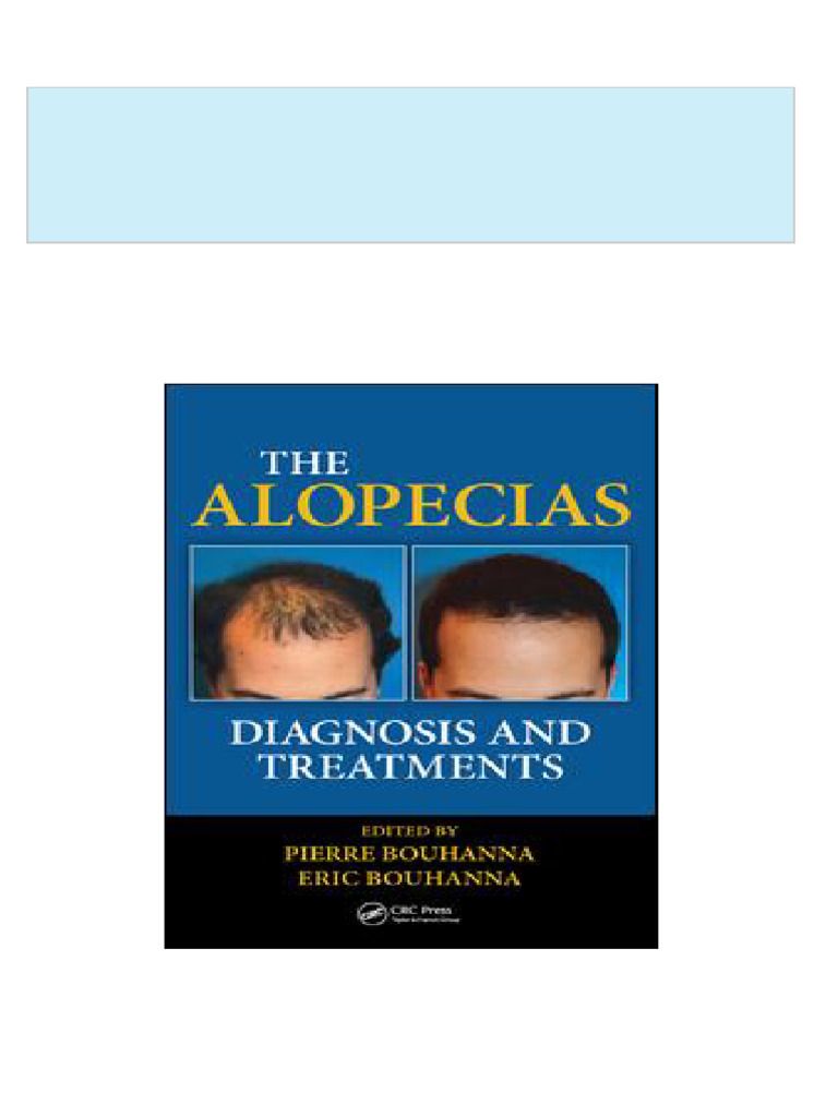 Download Full The Alopecias Diagnosis and Treatments 1st Edition Pierre ... Download Full The Alopecias Diagnosis and Treatments 1st Edition Pierre ...
