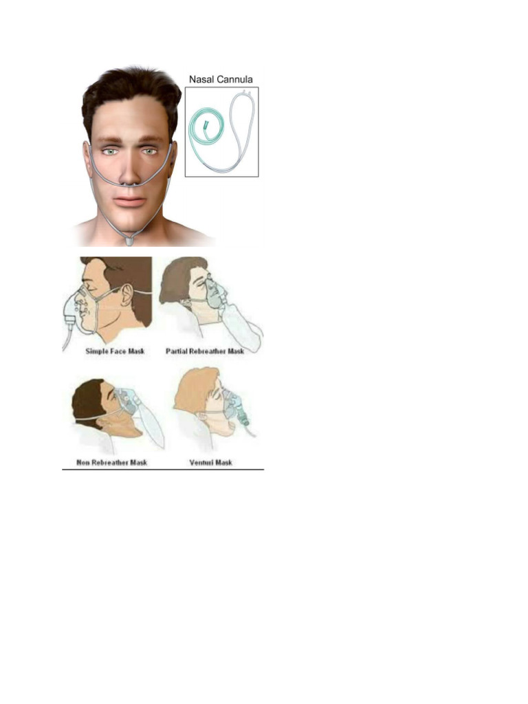 Oksigen Nasal Kanul Dan Masker | PDF
