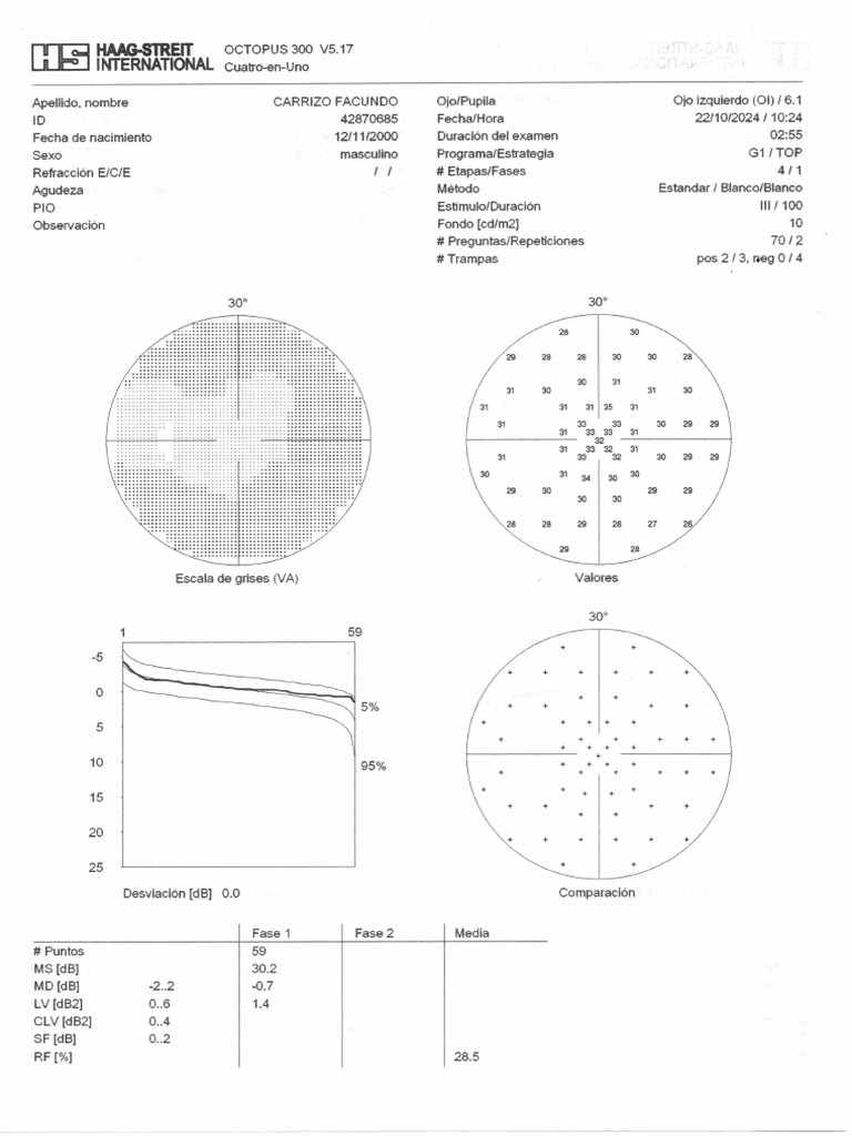 HC20715-Perimetria OI-20241022-105440-0002 | PDF