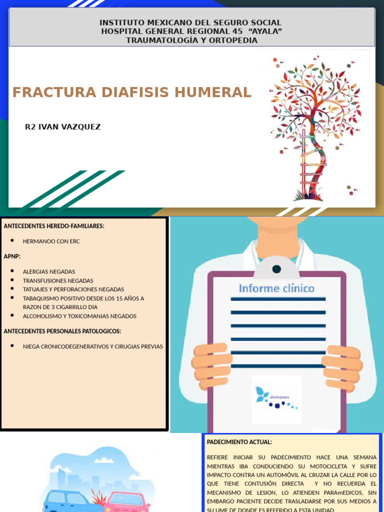 Fractura Diafisis Humeral | PDF | Codo | Sistema musculoesquelético