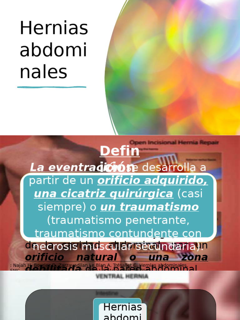 Hernias Abdominales | PDF | Abdomen
