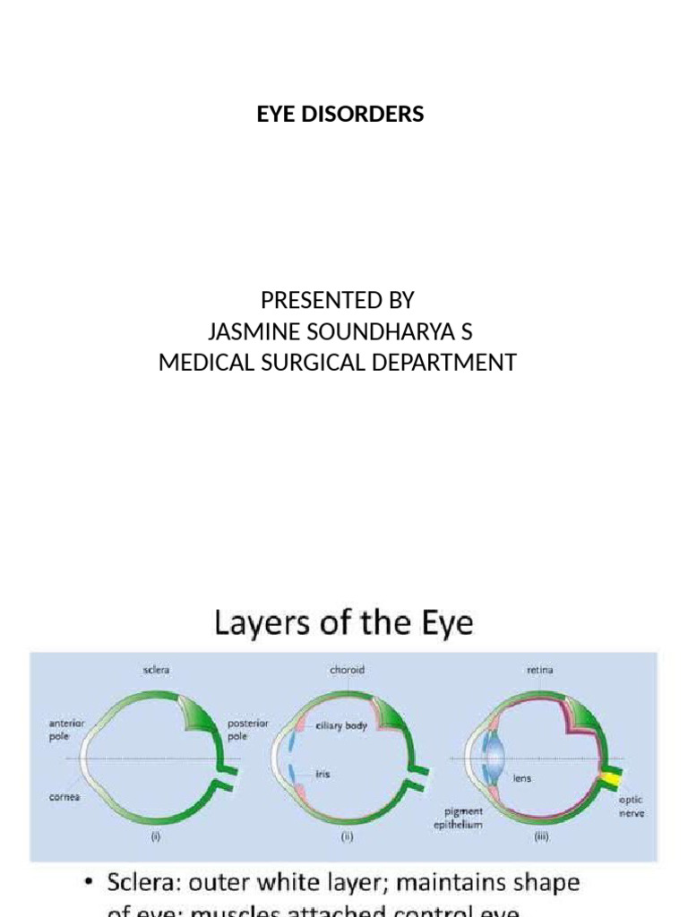 Eye Disorders | PDF