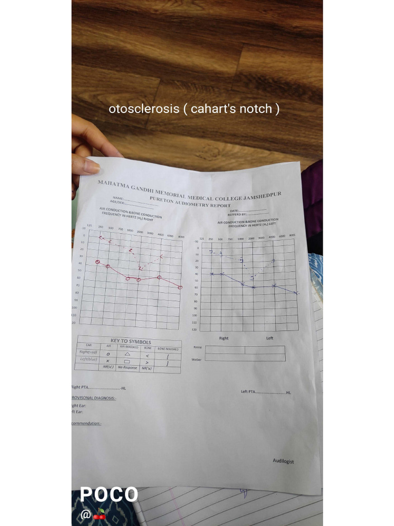 Ent Charts Review | PDF