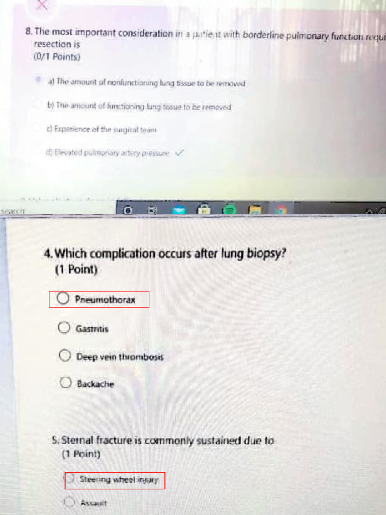 General Surgery Qppp | PDF