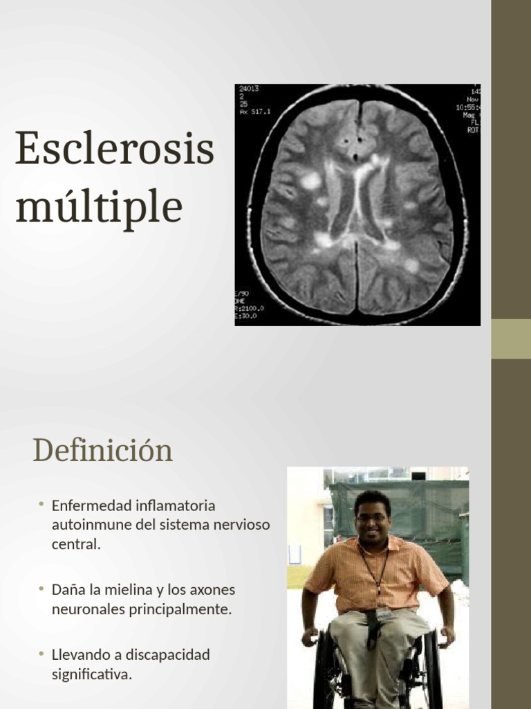 ¿Qué es la esclerosis múltiple? | PDF | Mielina | Medicina CLINICA