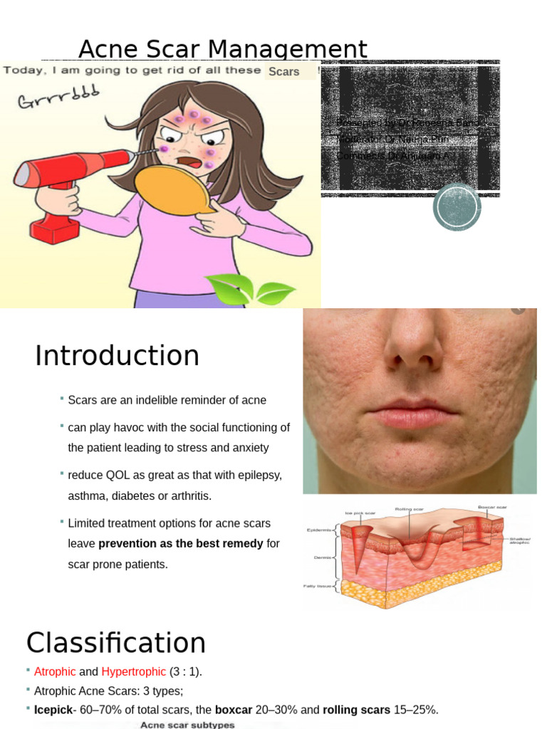 Acne scar mx | PDF | Scar | Laser