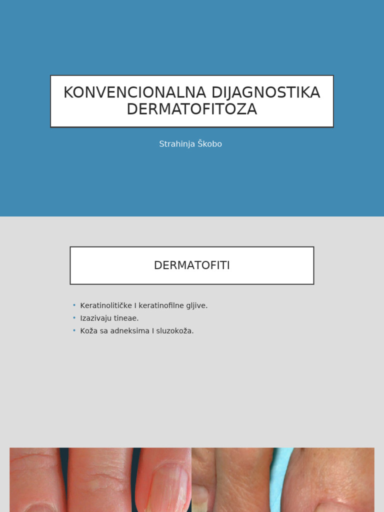 Dermatofiti | PDF