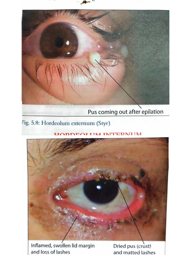 Eye Cat II Ospes | PDF